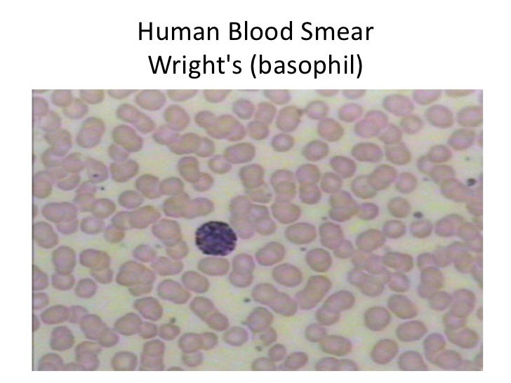 Wrights Stain Prepared Microscope Slide Smear Human Blood Film Slide ...