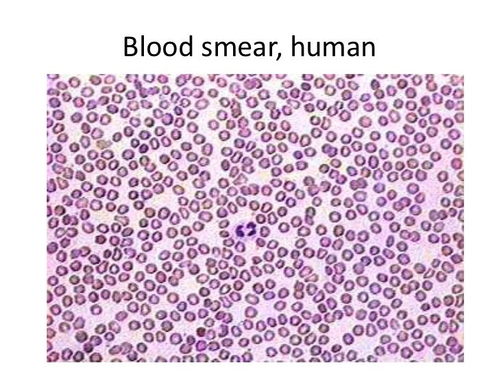 1 human blood, smear