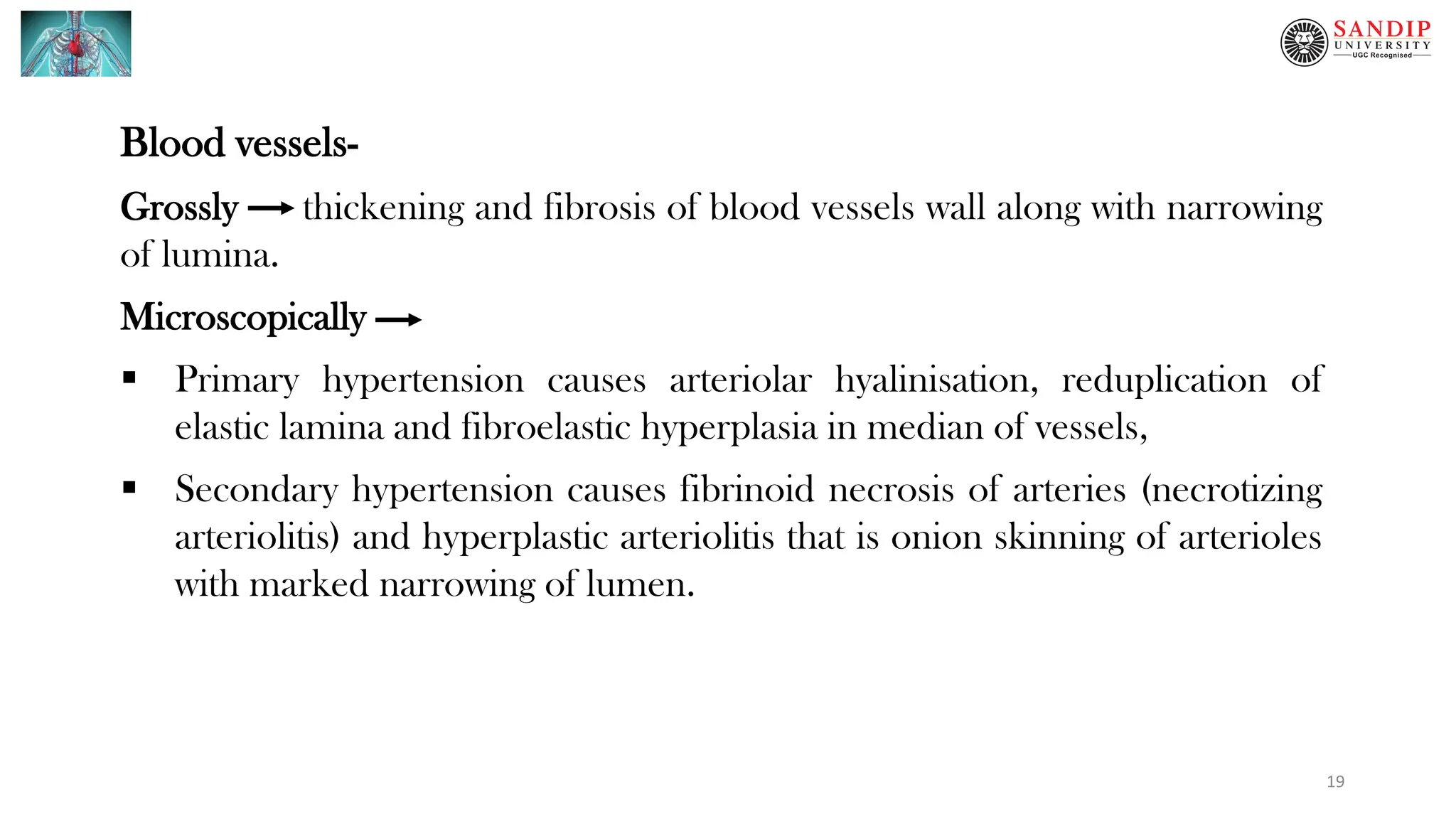 Cardiovascular Pathophysiology- Hypertension | PDF