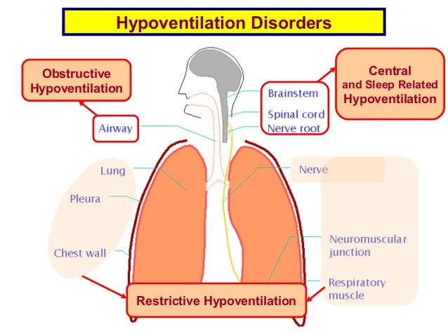 1 hypoventilation disorders
