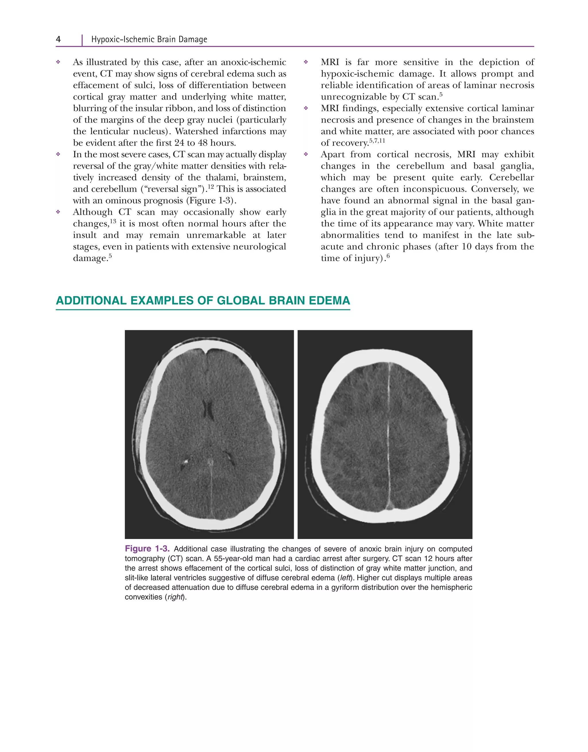 1 hypoxic ischemic brain damage | PDF
