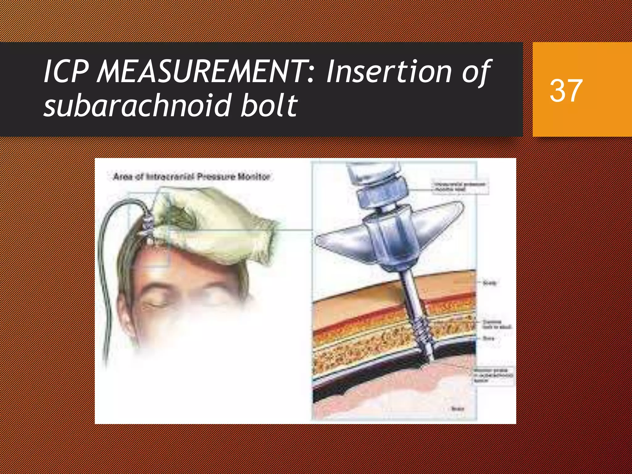 I LOVE NEUROSURGERY INITIATIVE: Increased Intracranial Pressure | PPT