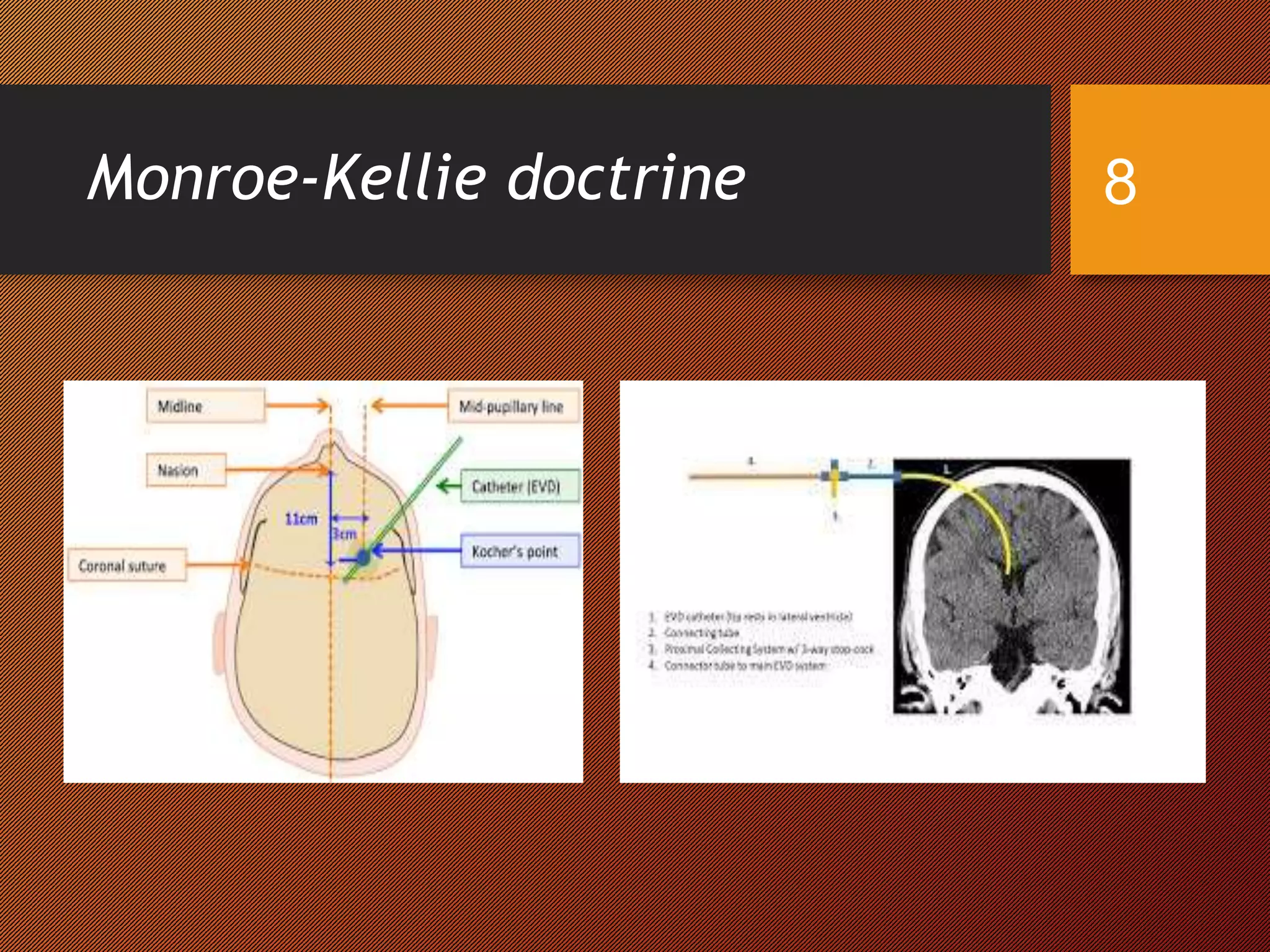 I LOVE NEUROSURGERY INITIATIVE: Increased Intracranial Pressure | PPT