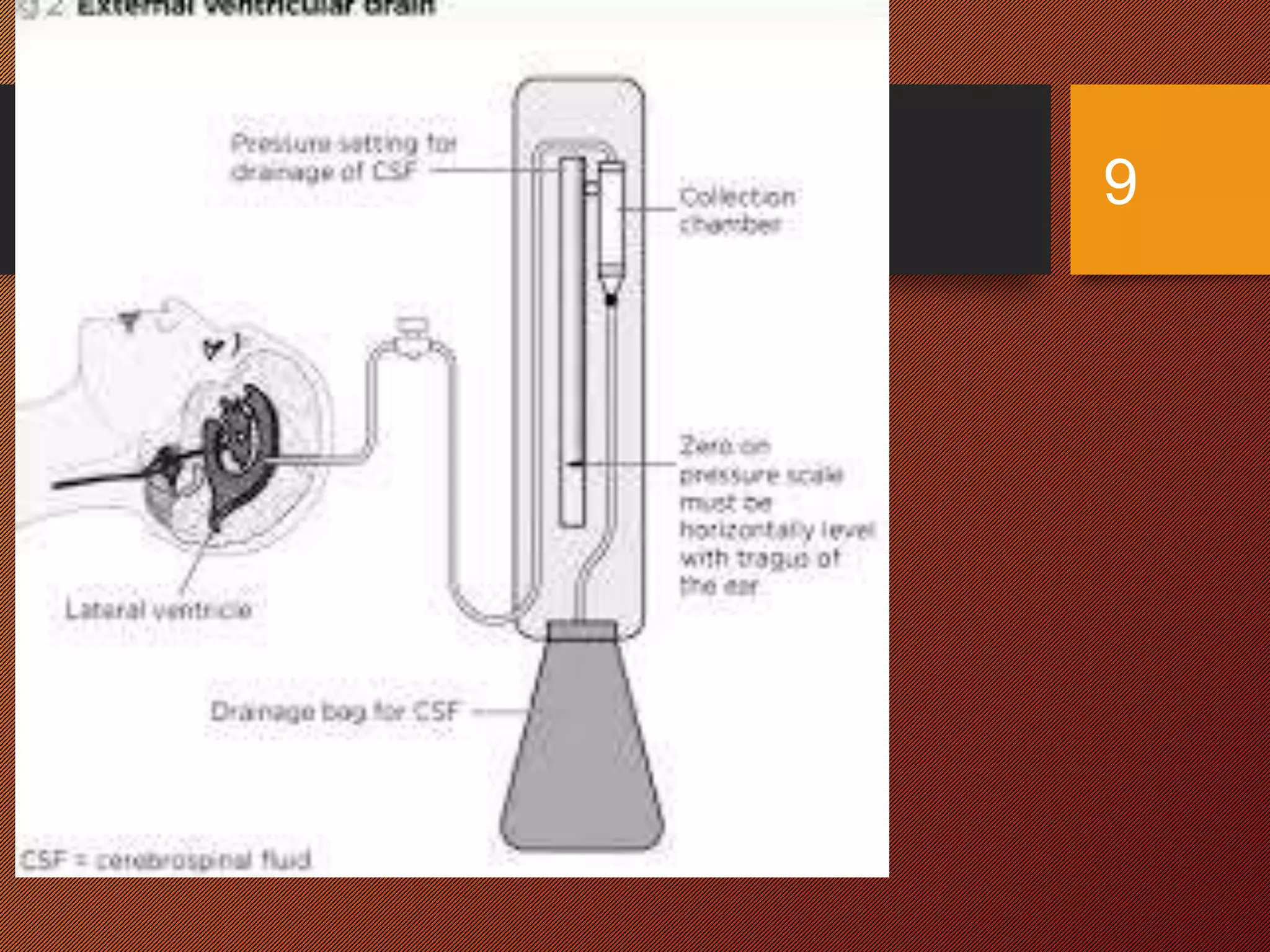 I LOVE NEUROSURGERY INITIATIVE: Increased Intracranial Pressure | PPT