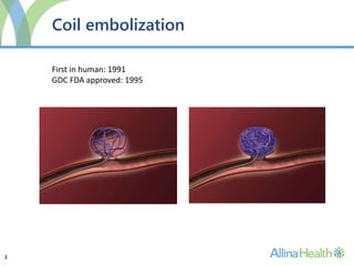 Endovascular treatment of brain aneurysms: Beyond coiling | PPTX