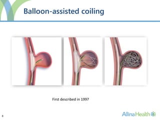 Endovascular treatment of brain aneurysms: Beyond coiling | PPTX ...