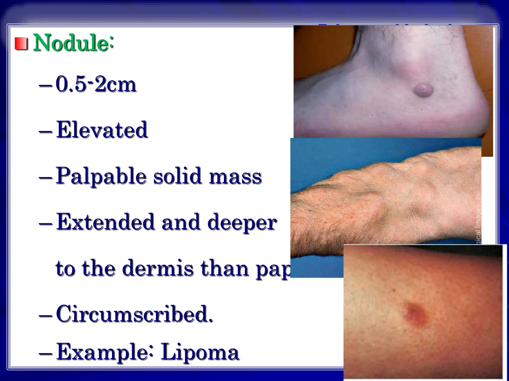 1 INTEGUMENTARY SYSTEM-June 2023.pptx
