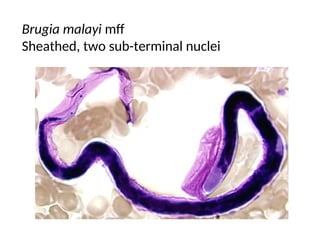Intestinal nematodes, Filarie & Vectors practicle.ppt