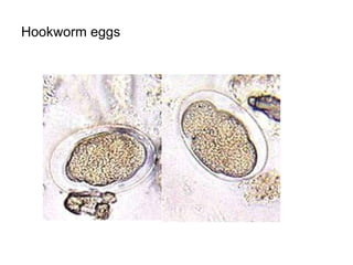Intestinal nematodes, Filarie & Vectors practicle.ppt