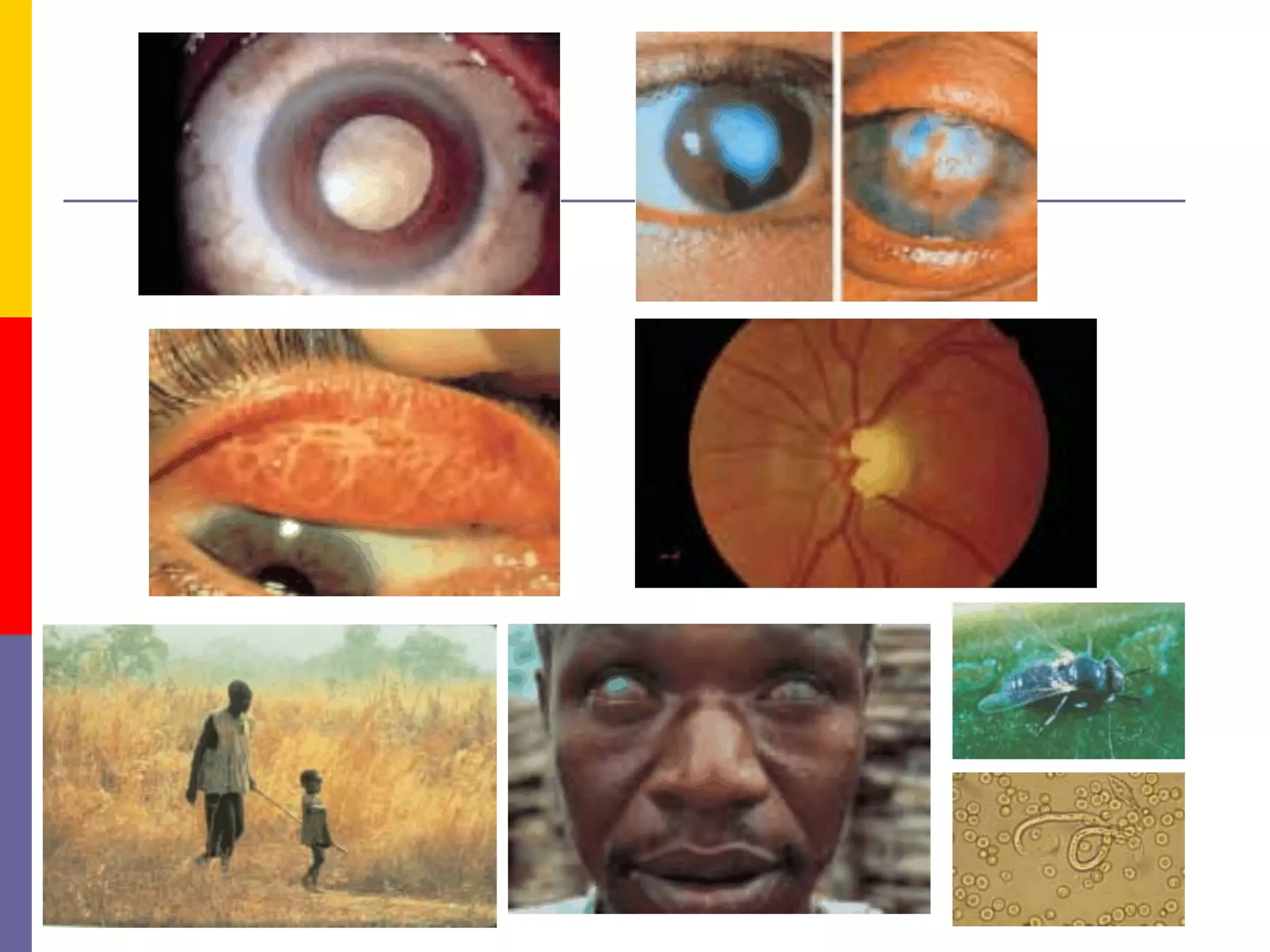 Introduction to Eye | PPT