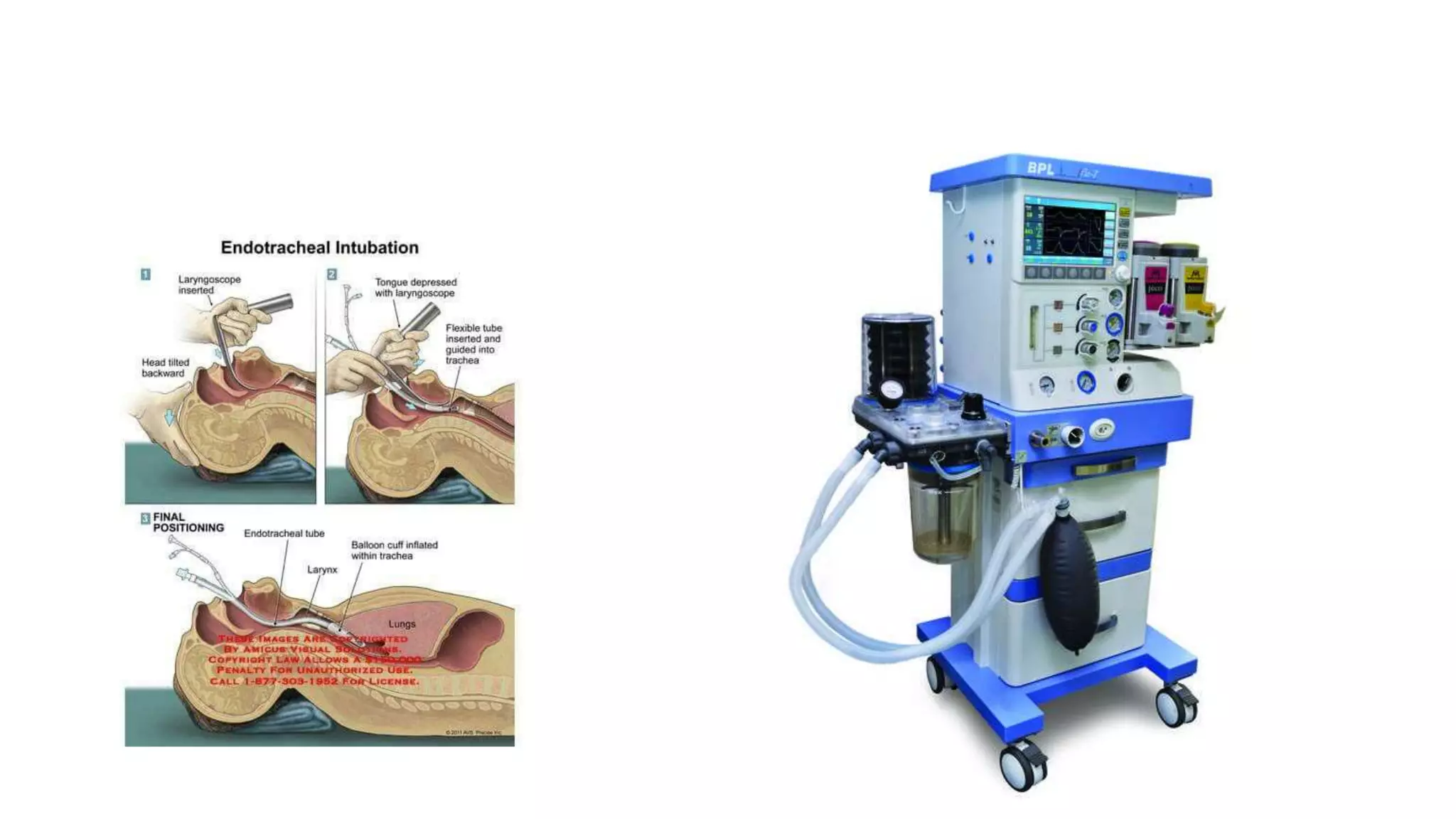 1 Introduction to Anesthesia.pptx