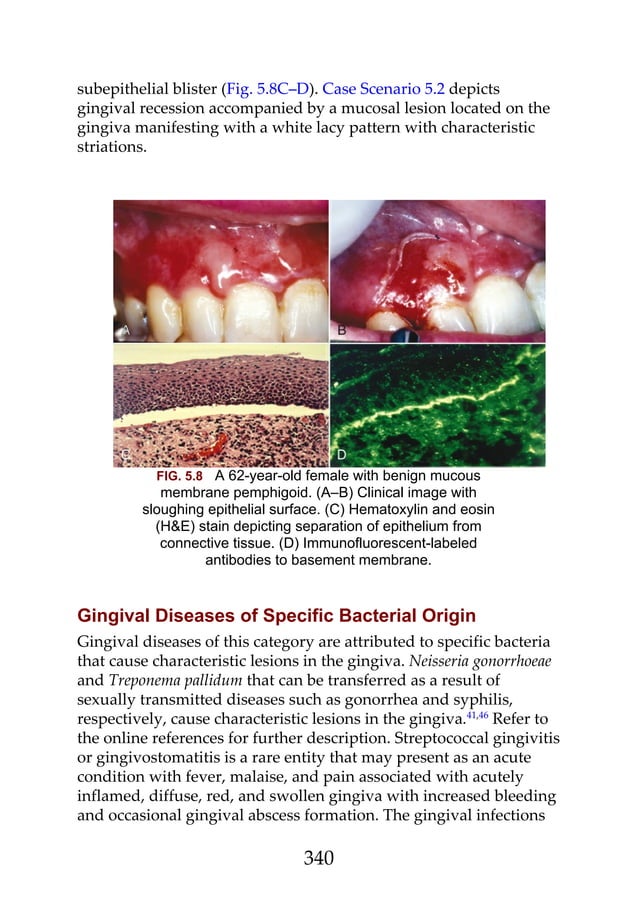 1, Klasifikasi Newman and Carranza's Clinical Periodontology E-Book.pdf