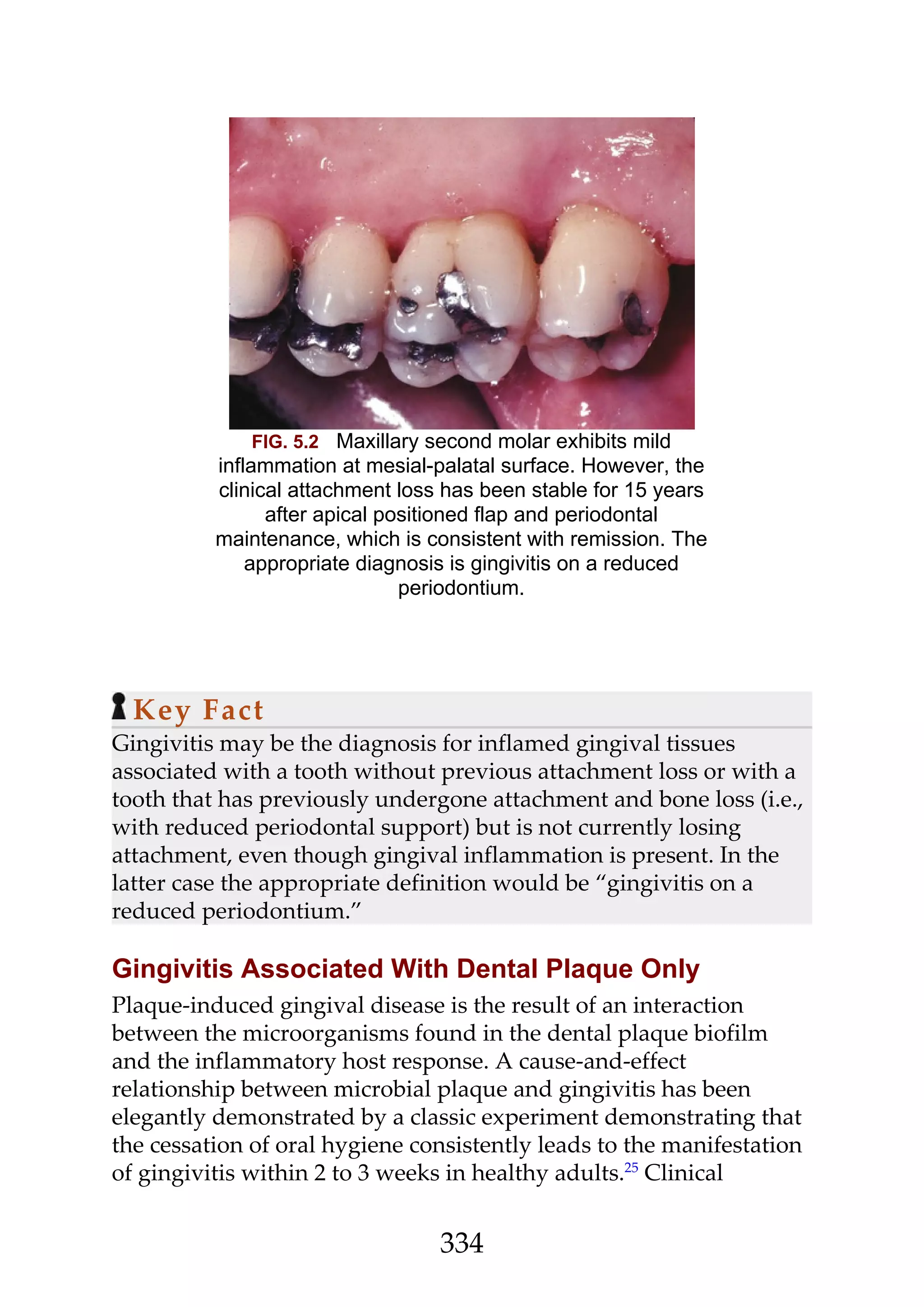 1, Klasifikasi Newman and Carranza's Clinical Periodontology E-Book.pdf