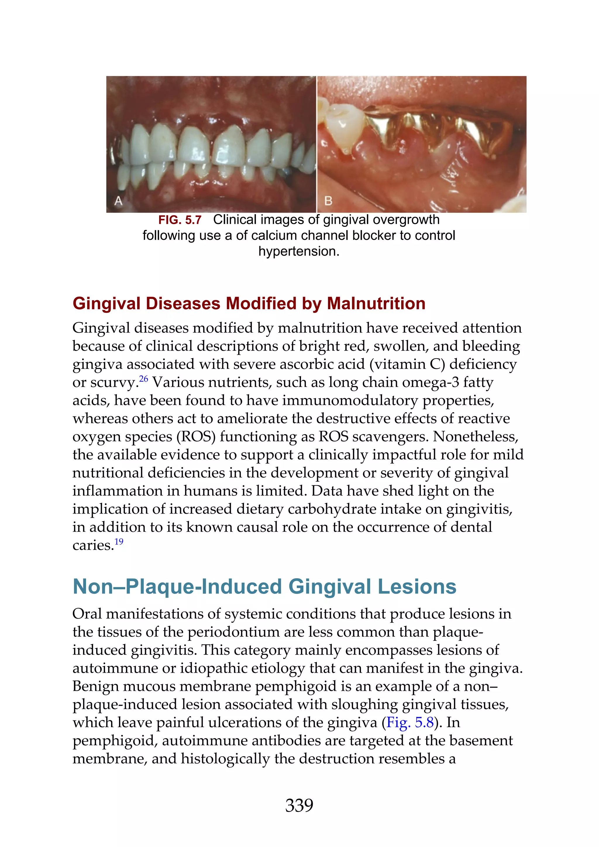 1, Klasifikasi Newman and Carranza's Clinical Periodontology E-Book.pdf