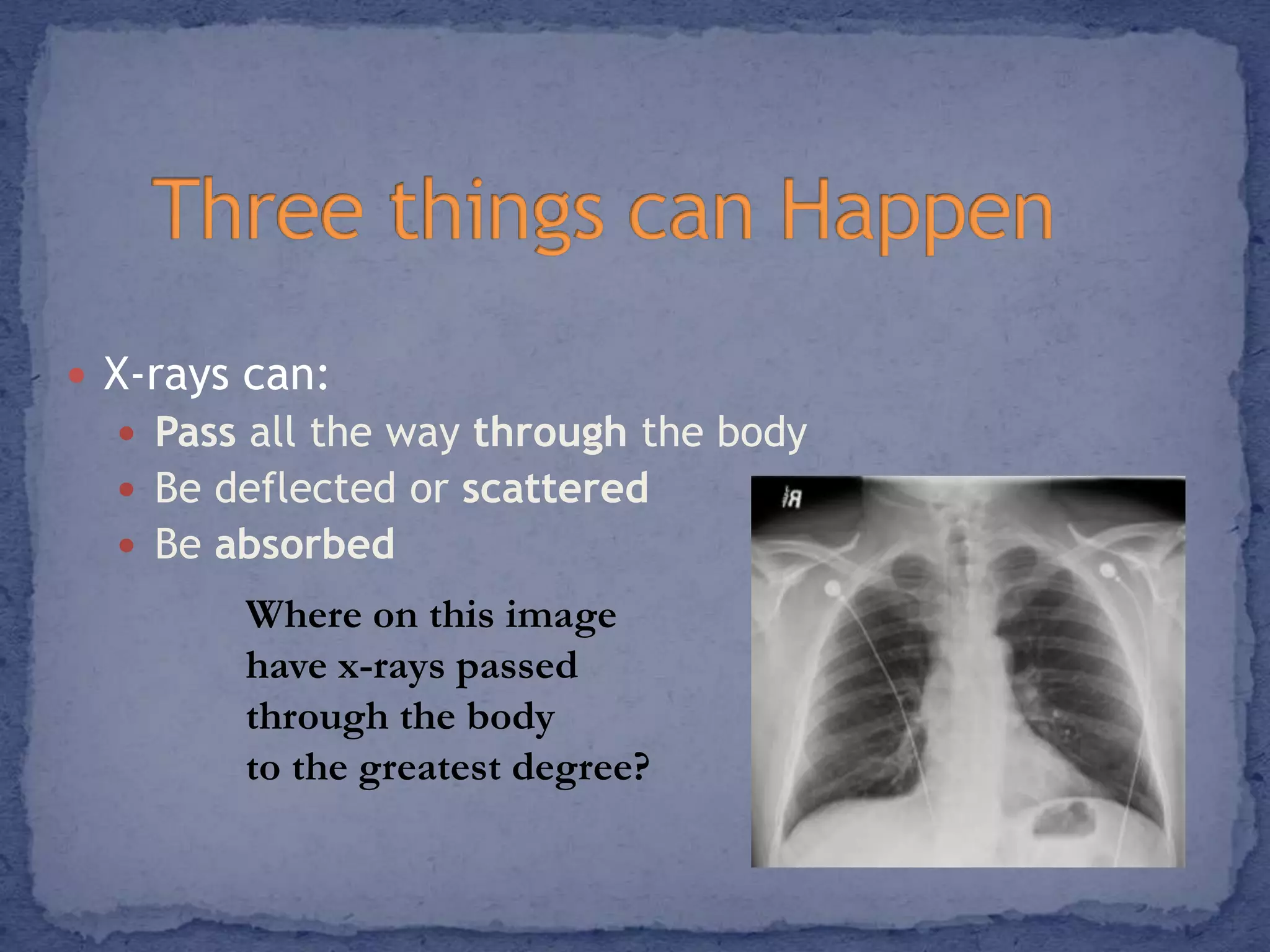 1lab Xray And Xray Tube Ppt 