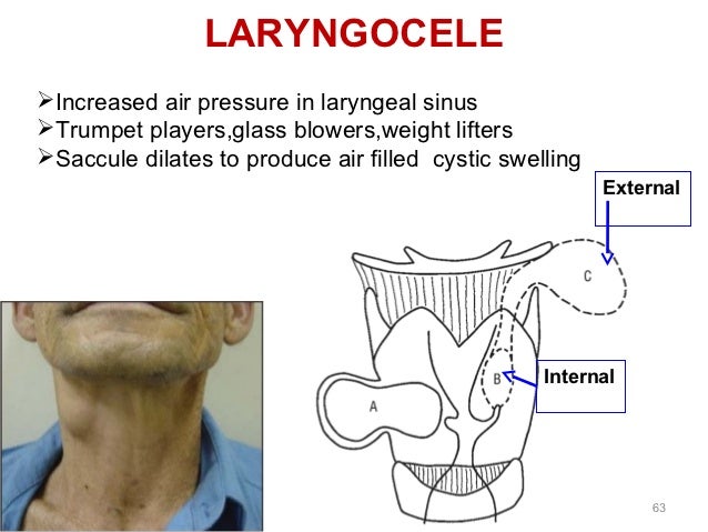 1 larynx ma
