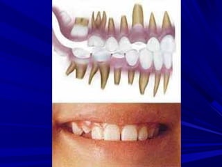 Life cycle of the teeth & tooth structure | PPT