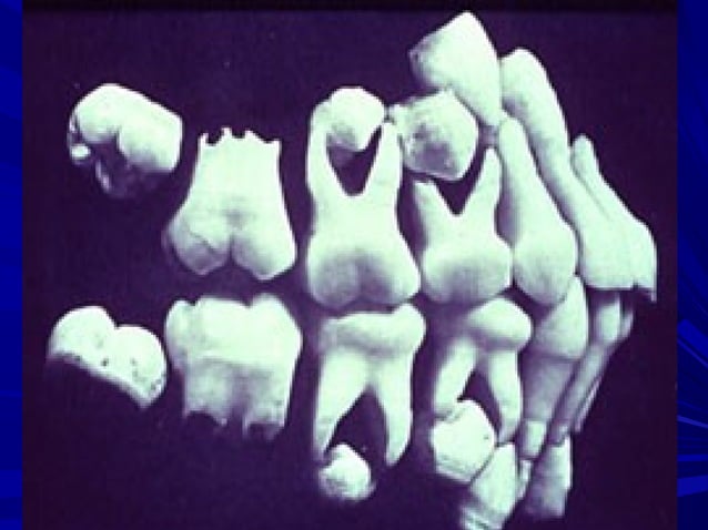 Life cycle of the teeth & tooth structure | PPT