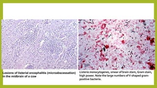 1 lec Listeriosis.pptx