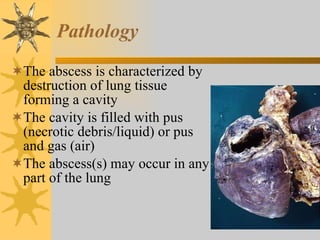 1 lung abscess(lh) | PPT