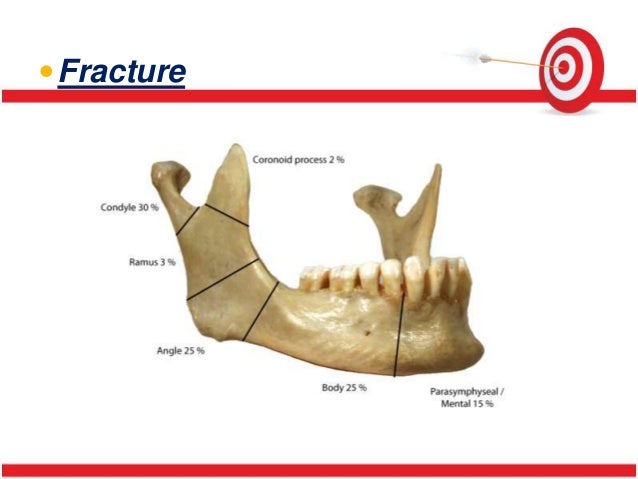 Mylohyoid Ridge JaypeeDigital | EBook Reader