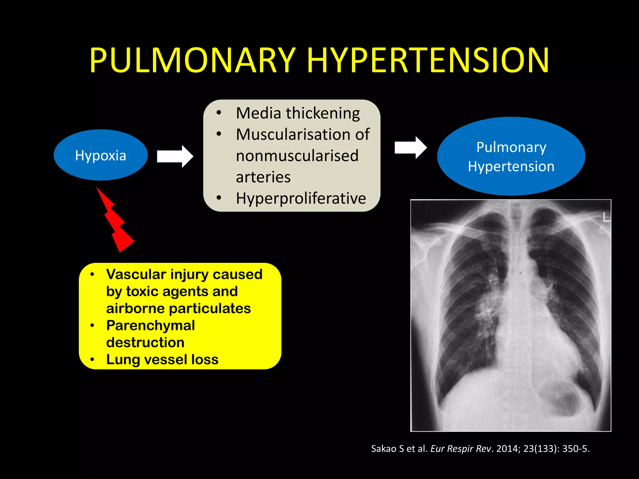 1_Mechanism_of_airway_obstruction_dr_arif_bachtiar.pdf