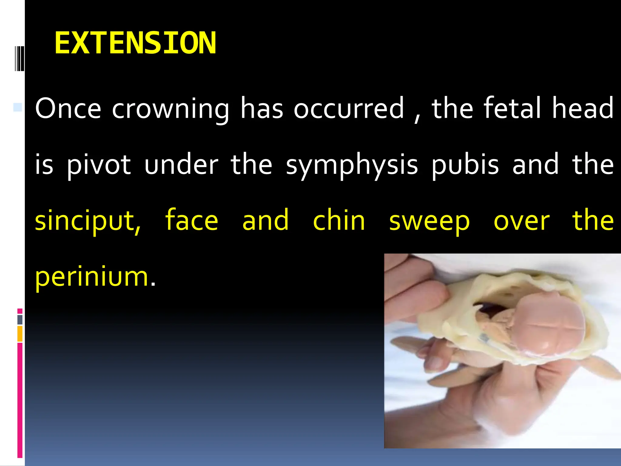 MECHANISM OF LABOUR- OBSTETRICS AND GYNAECOLOGY | PPT