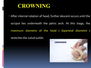 MECHANISM OF LABOUR- OBSTETRICS AND GYNAECOLOGY | PPT