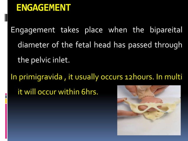 MECHANISM OF LABOUR- OBSTETRICS AND GYNAECOLOGY | PPT | Pregnancy ...