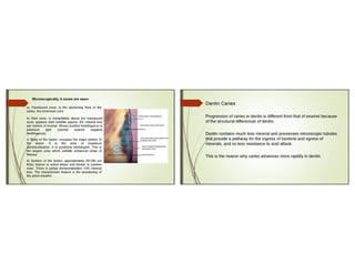 1_Module_1__Introduction_to_Cariology_The_Dental_Caries_Process_and_its ...