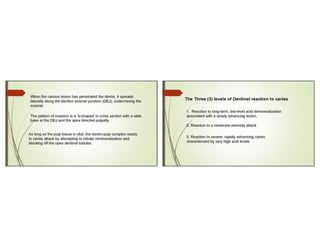 1_Module_1__Introduction_to_Cariology_The_Dental_Caries_Process_and_its ...