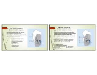 1_Module_1__Introduction_to_Cariology_The_Dental_Caries_Process_and_its ...