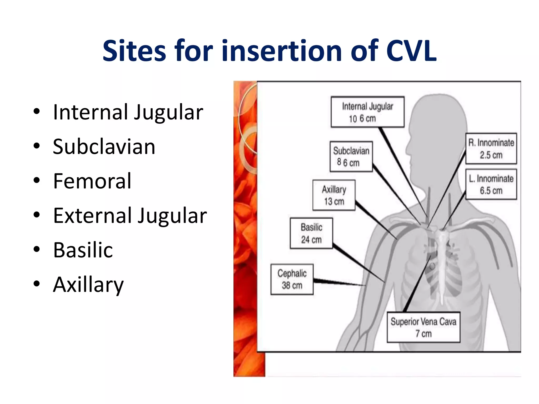 1 Monitoring of Central Venous Pressure & Its Techniques | PPTX