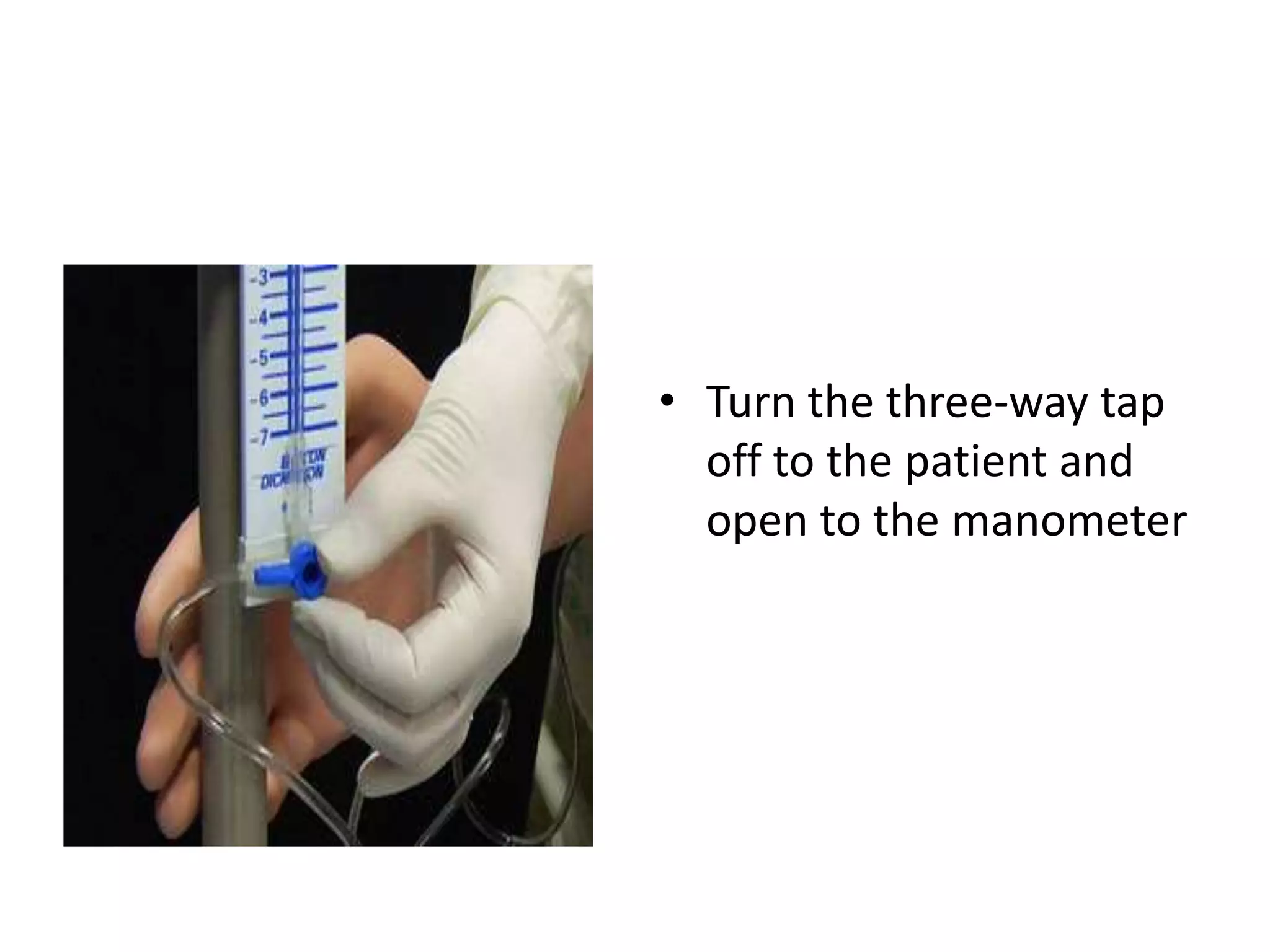 1 Monitoring of Central Venous Pressure & Its Techniques | PPTX