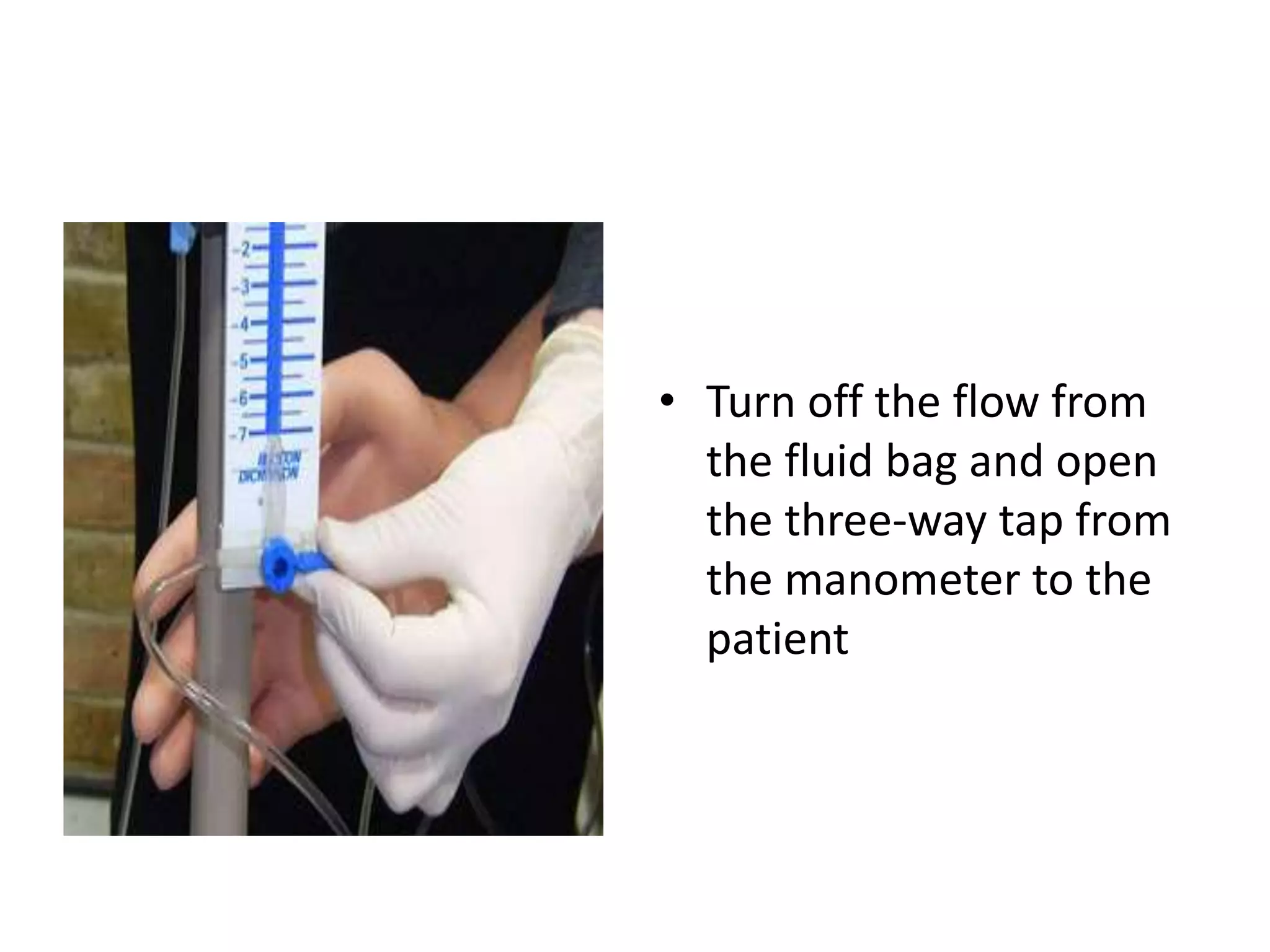 1 Monitoring of Central Venous Pressure & Its Techniques | PPTX