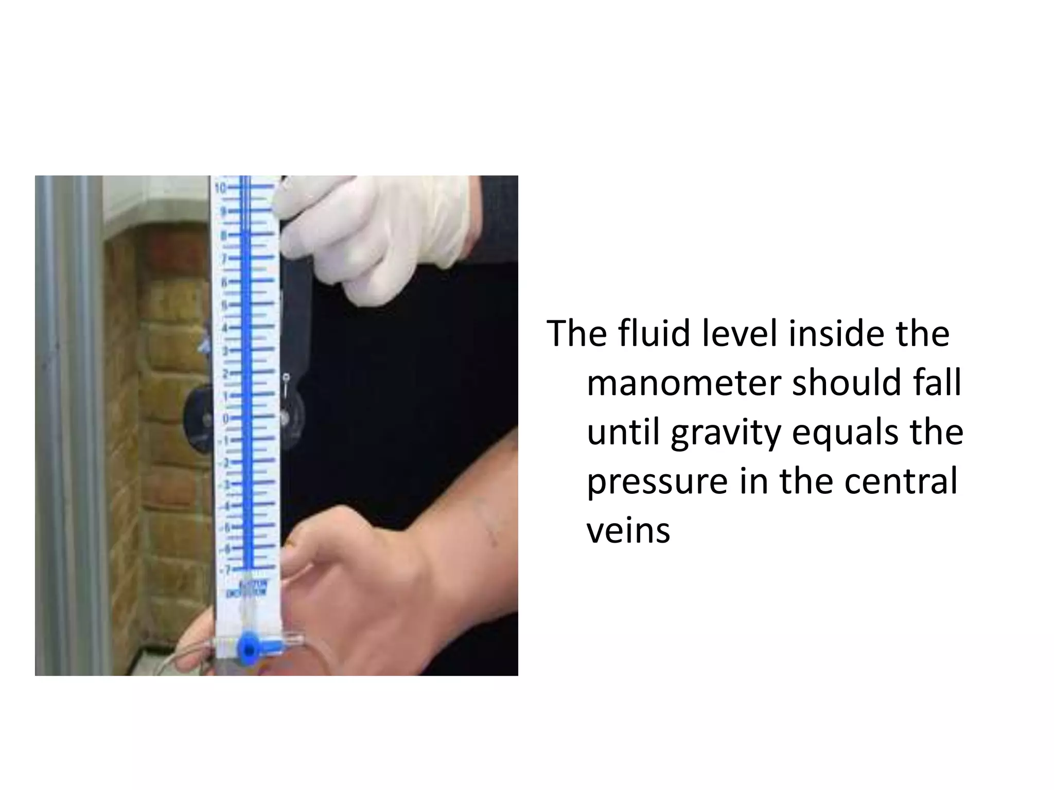 1 Monitoring of Central Venous Pressure & Its Techniques | PPTX