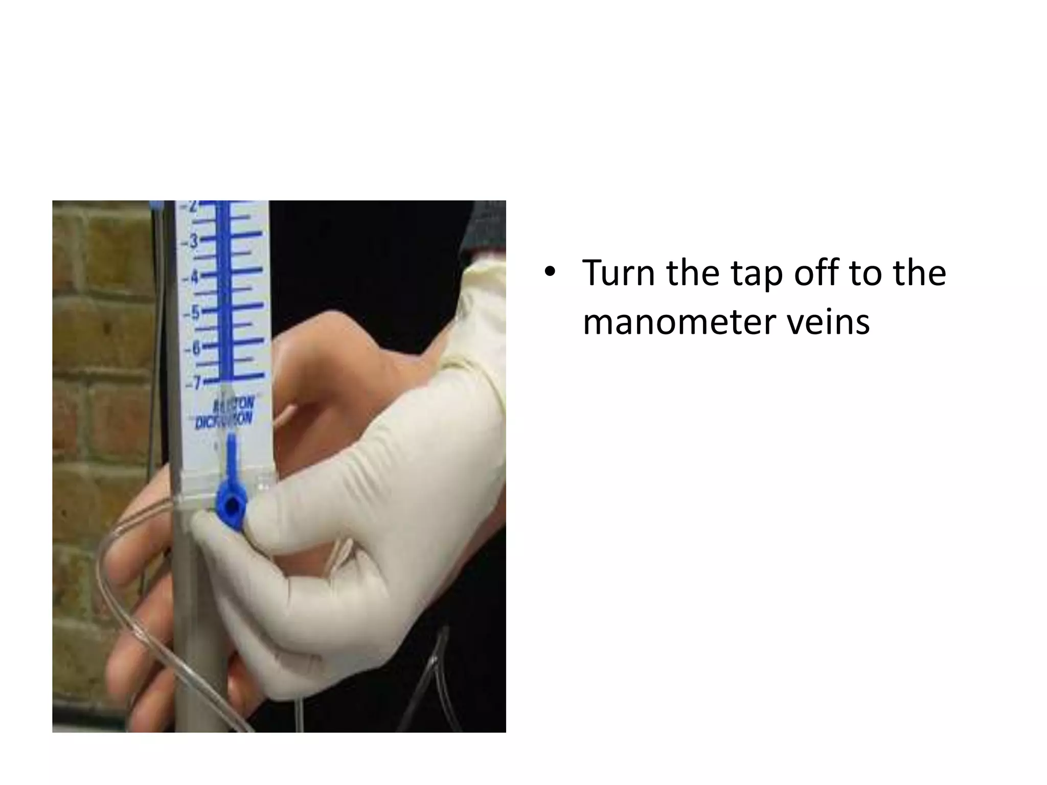 1 Monitoring of Central Venous Pressure & Its Techniques | PPTX