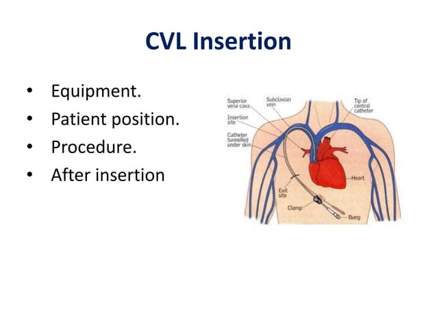 1 Monitoring of Central Venous Pressure & Its Techniques | PPTX