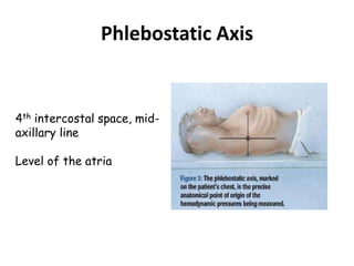 1 Monitoring of Central Venous Pressure & Its Techniques | PPTX