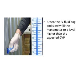 1 Monitoring of Central Venous Pressure & Its Techniques | PPTX