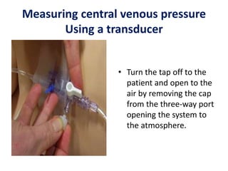 1 Monitoring of Central Venous Pressure & Its Techniques | PPTX