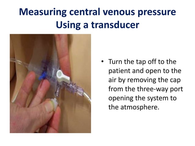 1 Monitoring of Central Venous Pressure & Its Techniques | PPTX