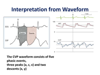 1 Monitoring of Central Venous Pressure & Its Techniques | PPTX