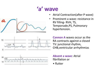 1 Monitoring of Central Venous Pressure & Its Techniques | PPT
