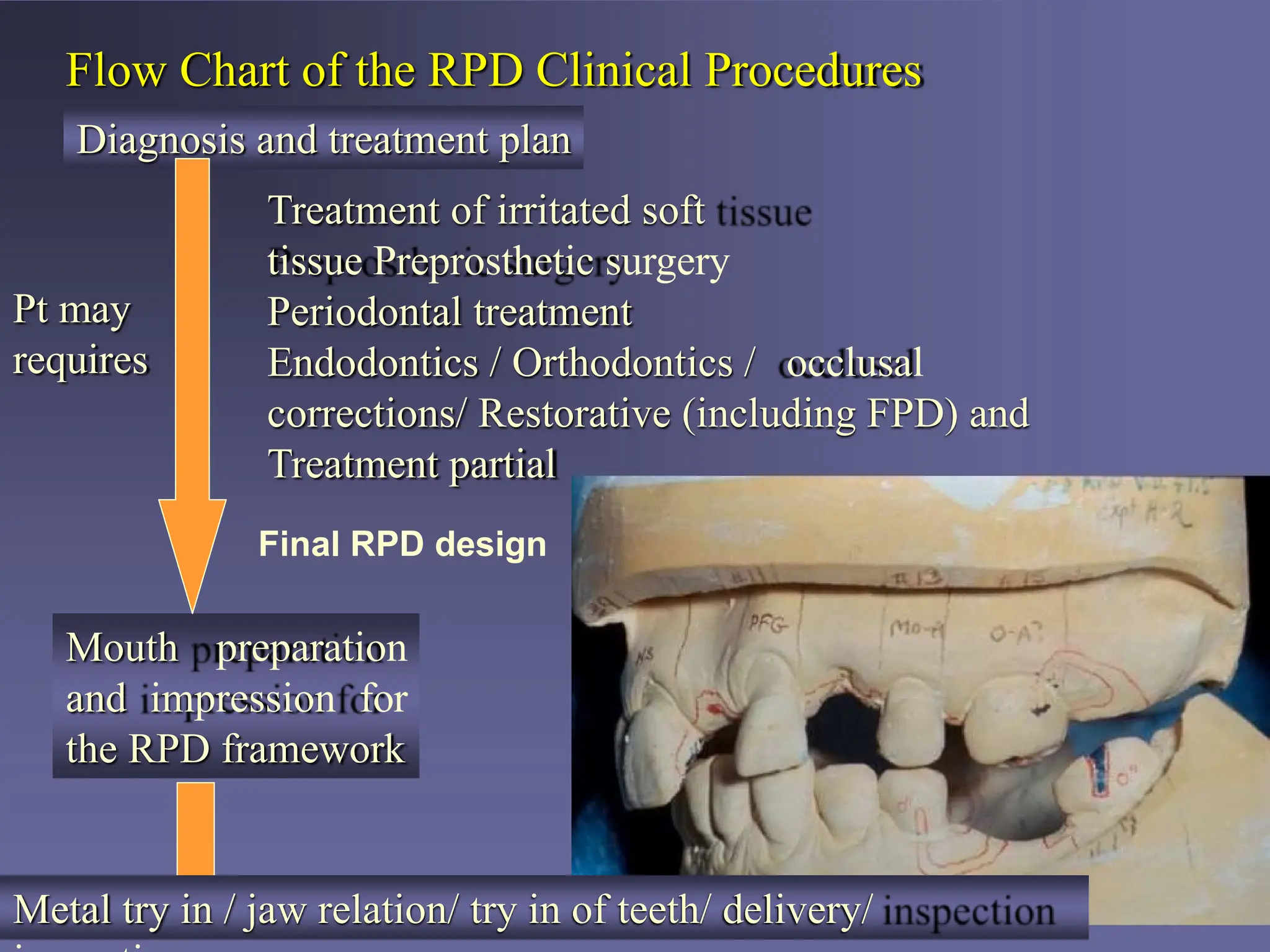 (1)Mouth preparation for removable partial denture march 2020 ppt.pptx