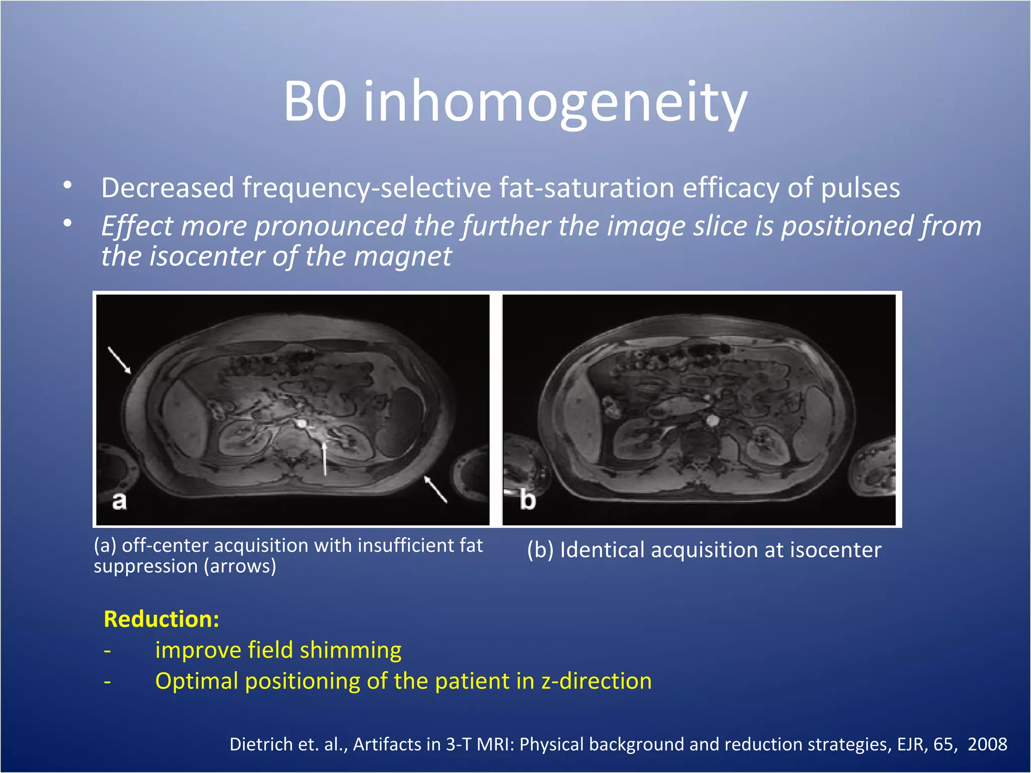 Distortion Artifacts In Mri And Their Correction Ppt