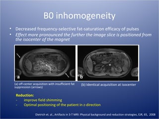Distortion Artifacts in MRI and their correction | PPT