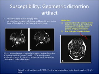 Distortion Artifacts in MRI and their correction | PPT