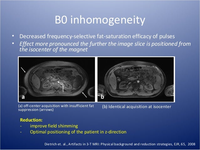 Distortion Artifacts In Mri And Their Correction