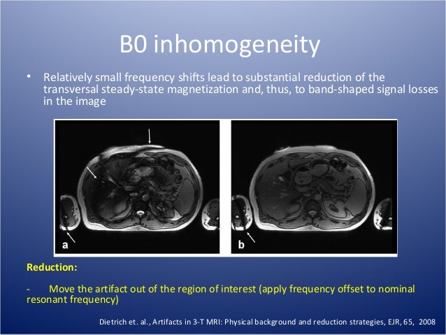 Distortion Artifacts In Mri And Their Correction